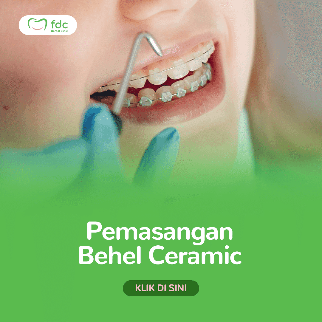 Daftar Harga - FDC Dental Clinic