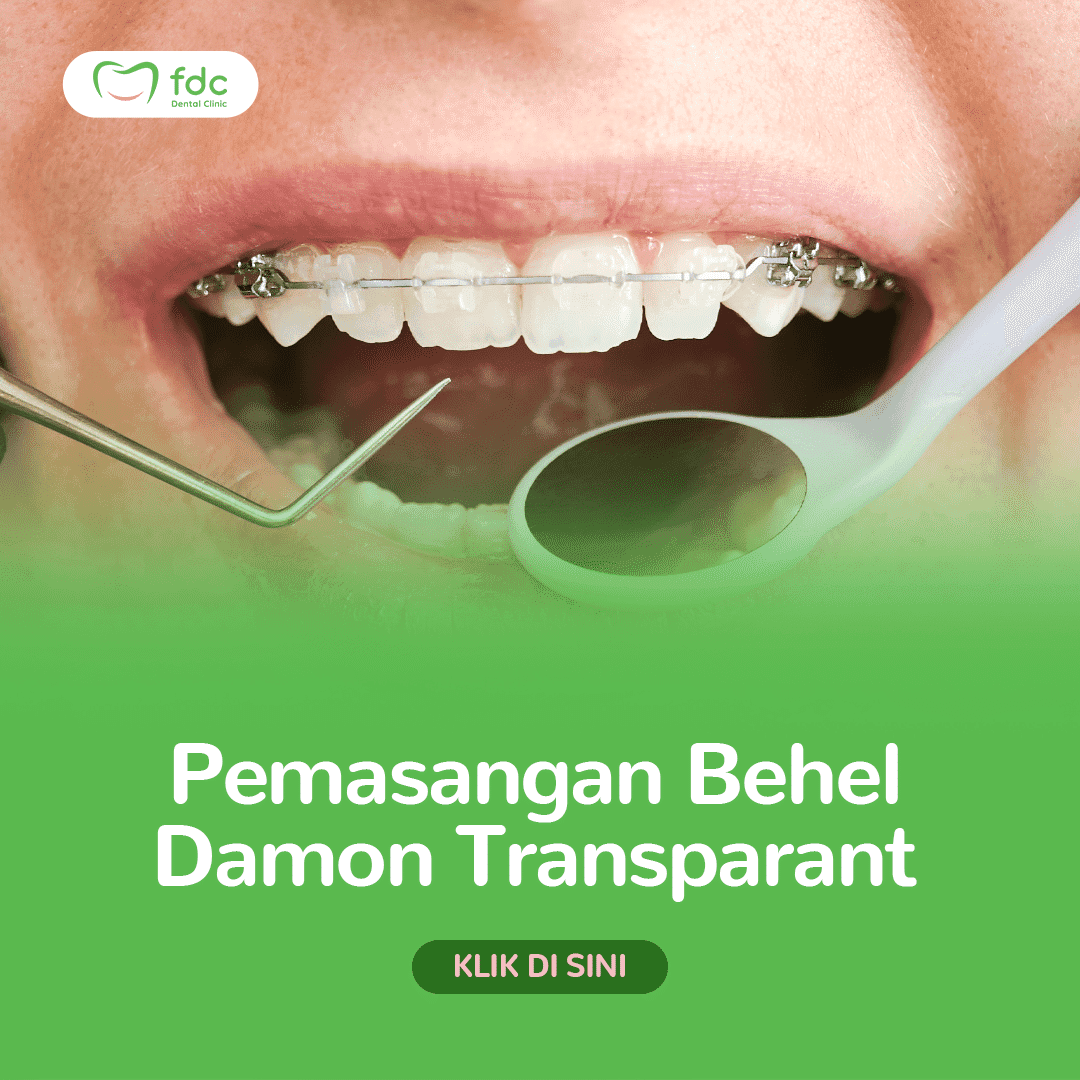 Daftar Harga - FDC Dental Clinic