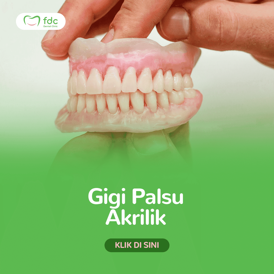 [Normal] Gigi Palsu Akrilik 1.500K