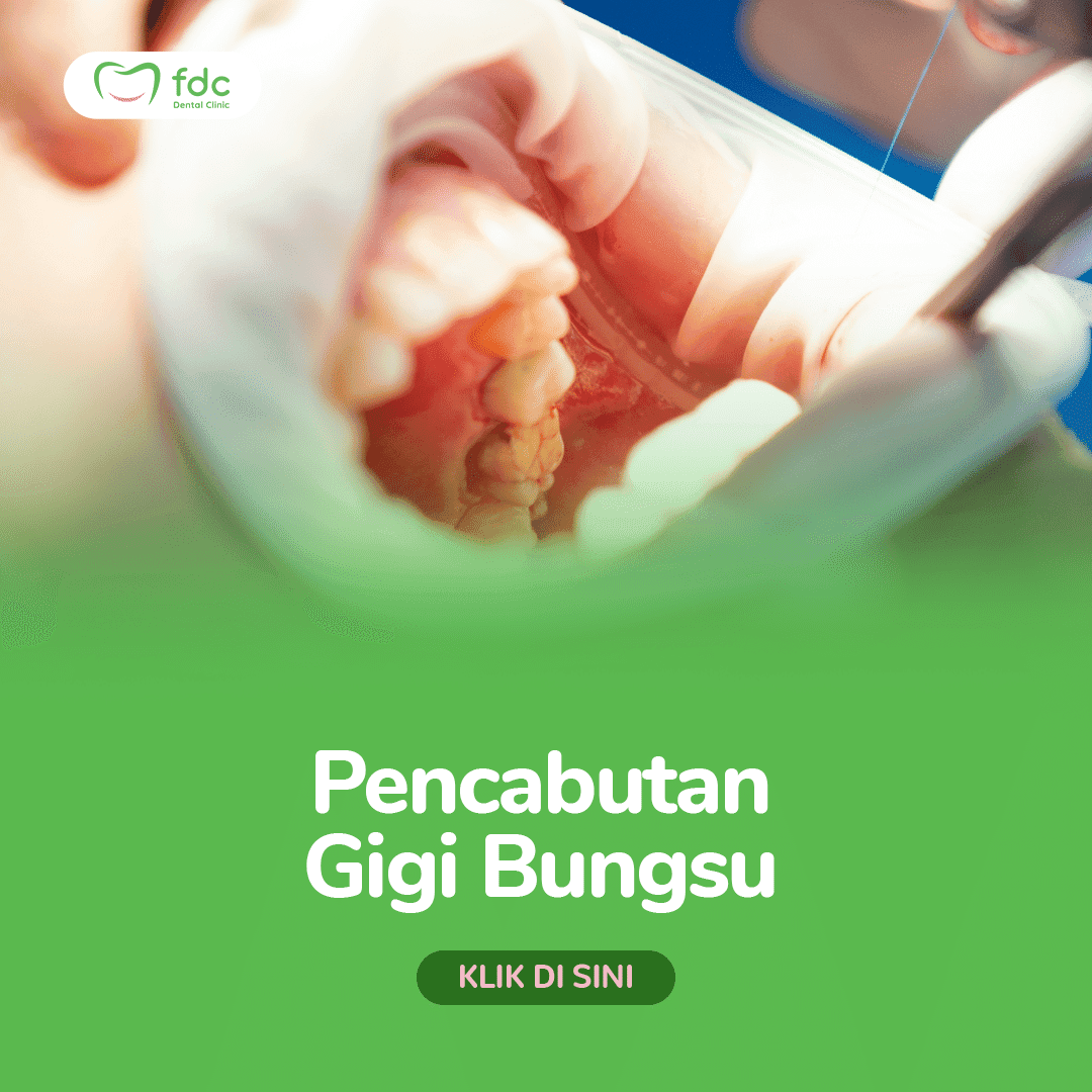 Daftar Harga - FDC Dental Clinic