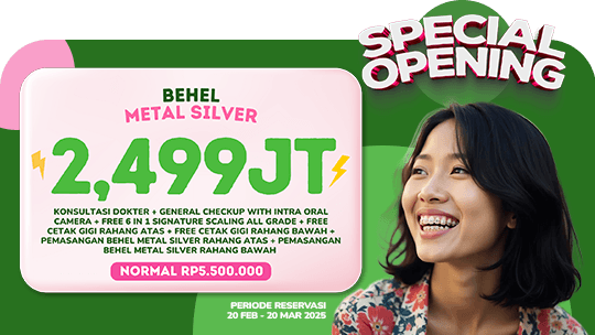 Flash Promo - Behel Metal Silver