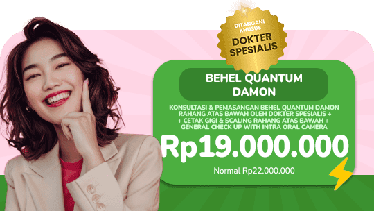 Promo Behel Quantum Damon (Spesialis)