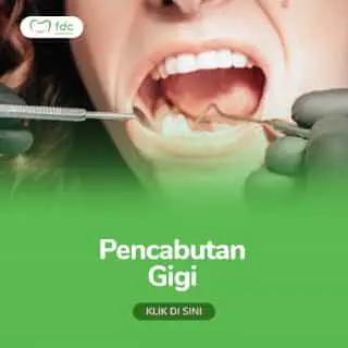 Beberapa Kondisi Tidak Boleh Cabut Gigi yang Wajib Diketahui