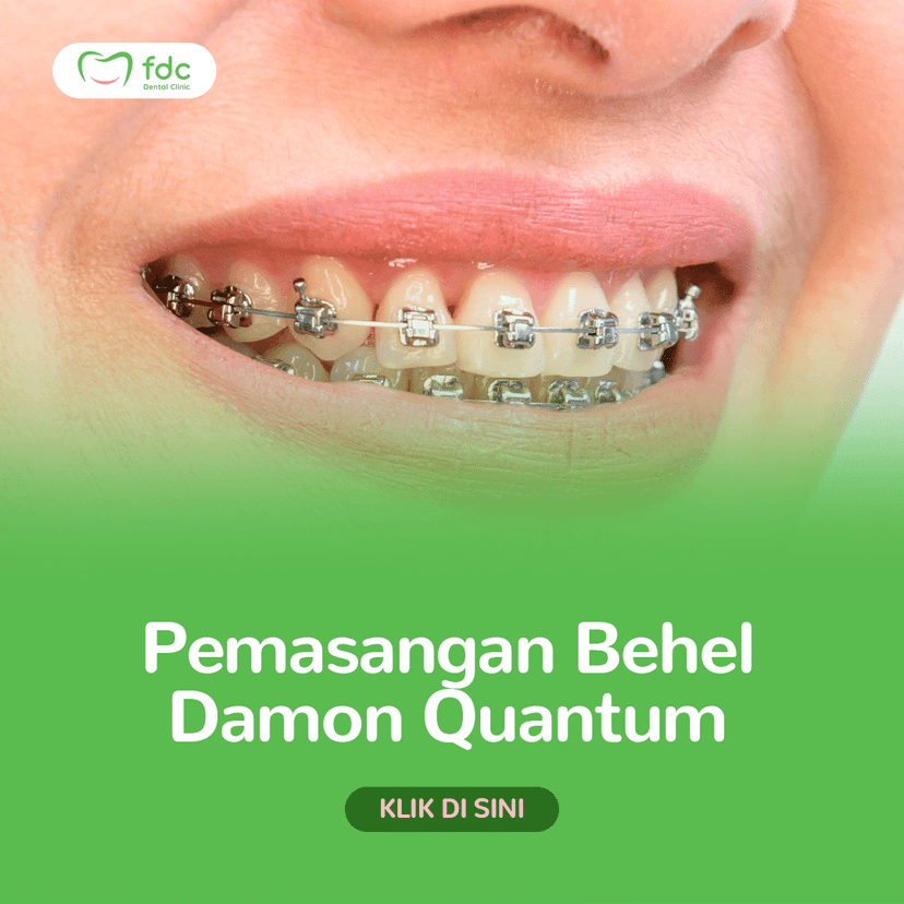 Behel Damon Quantum