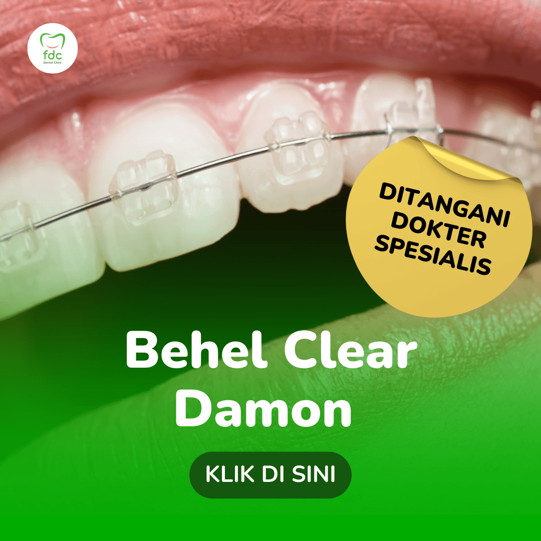 Klinik Gigi Jakarta Selatan - FDC Menteng - FDC Dental Clinic