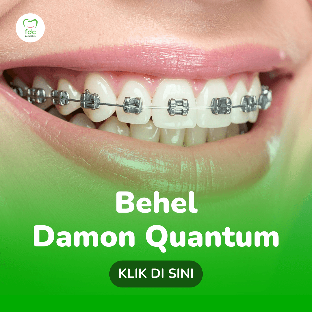 Daftar Harga - FDC Dental Clinic