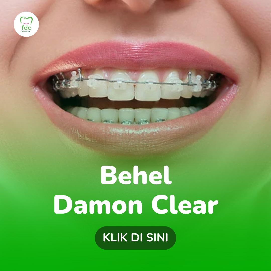 Daftar Harga - FDC Dental Clinic