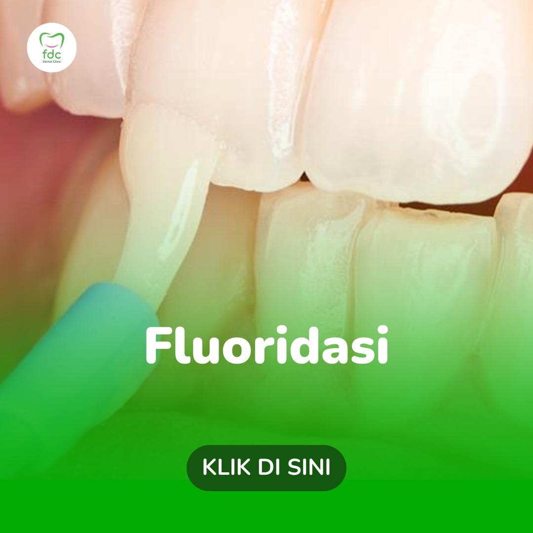 Daftar Harga - FDC Dental Clinic