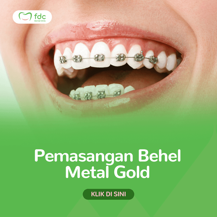 Daftar Harga - FDC Dental Clinic